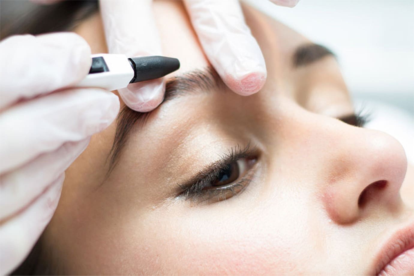 Electrolysis Hair Removal | Beau Clinic | Kent Cosemtic Clinic